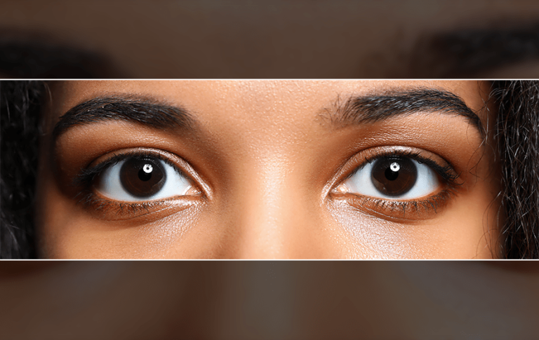Refractive Errors of Eye: Types, Causes & Treatment Options