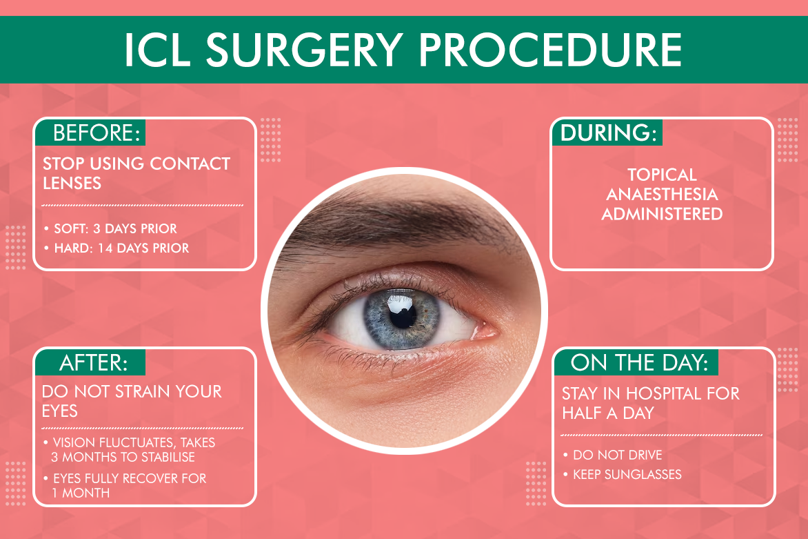 How to prepare for your ICL surgery? | Planet Lasik - Best Eye Care Center | Lasik & Refractive ...