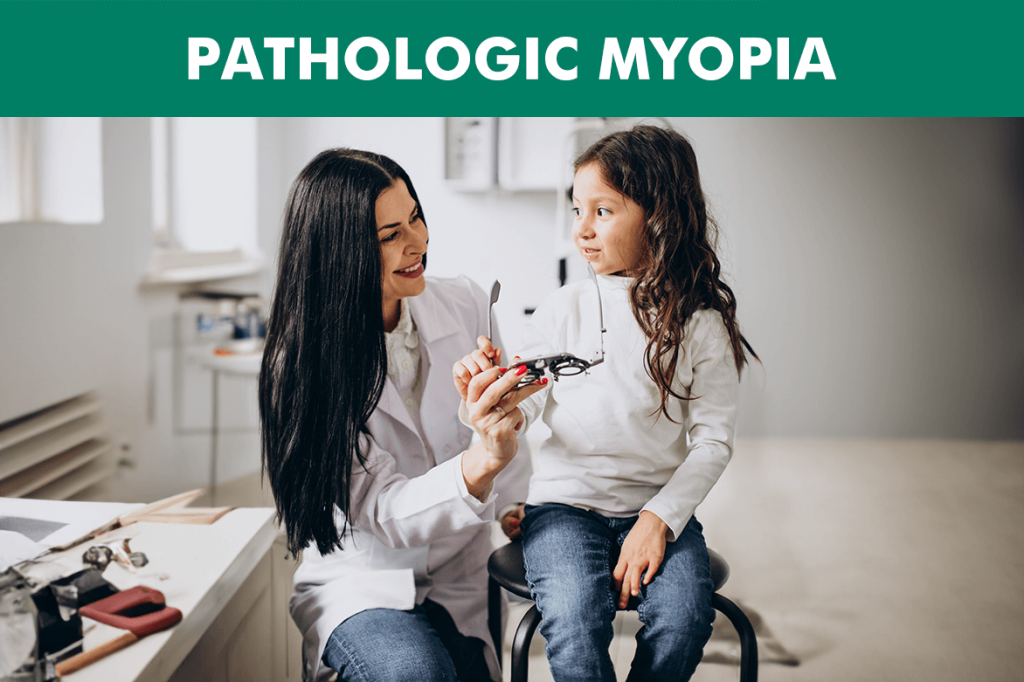 Pathologic Myopia: Causes, Symptoms, and Treatment Options