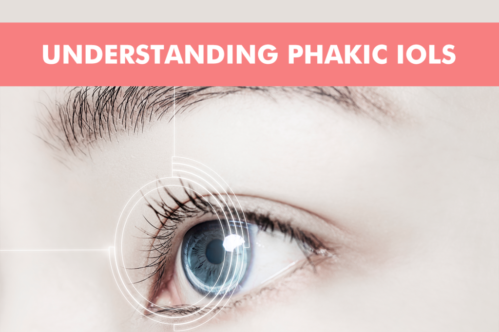 Understanding Phakic IOLs - How Do They Work? | Planet Lasik