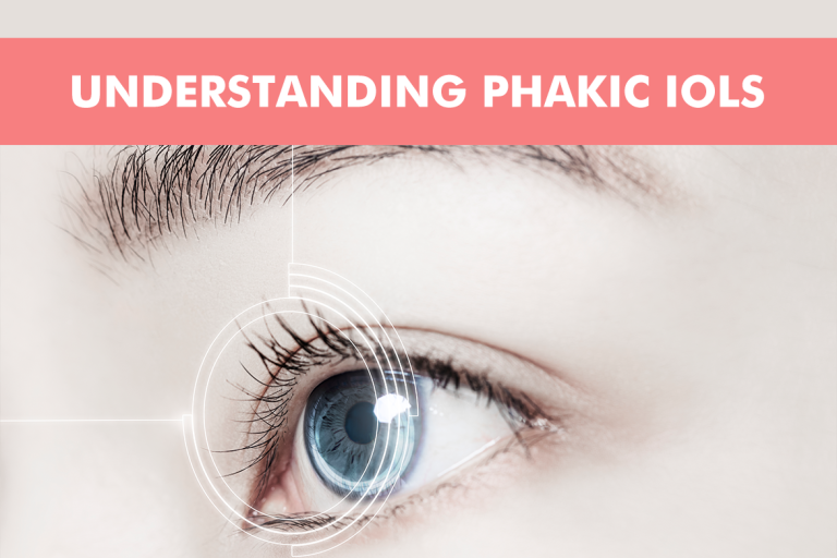 Understanding Phakic IOLs - How Do They Work? | Planet Lasik