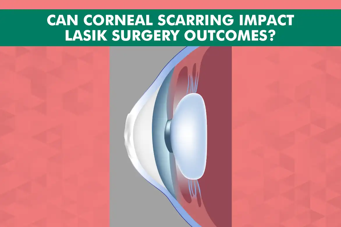 Can Corneal Scarring Impact LASIK Surgery Outcomes?
