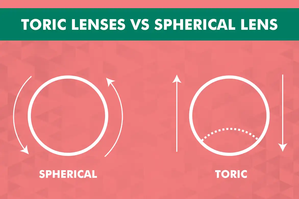 Toric vs Spherical Lens: Which Type of ICL is Better?