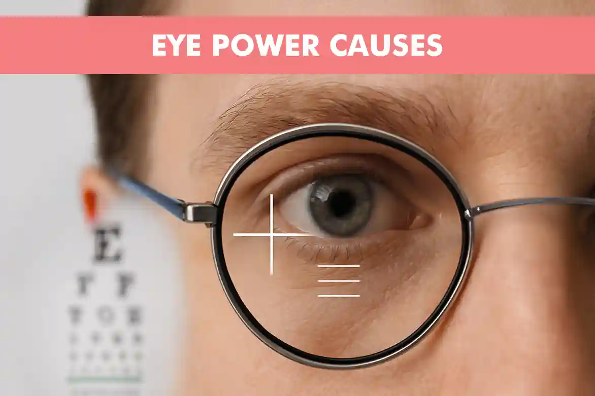 Eye Power Causes: Why It Increases & How to Prevent It