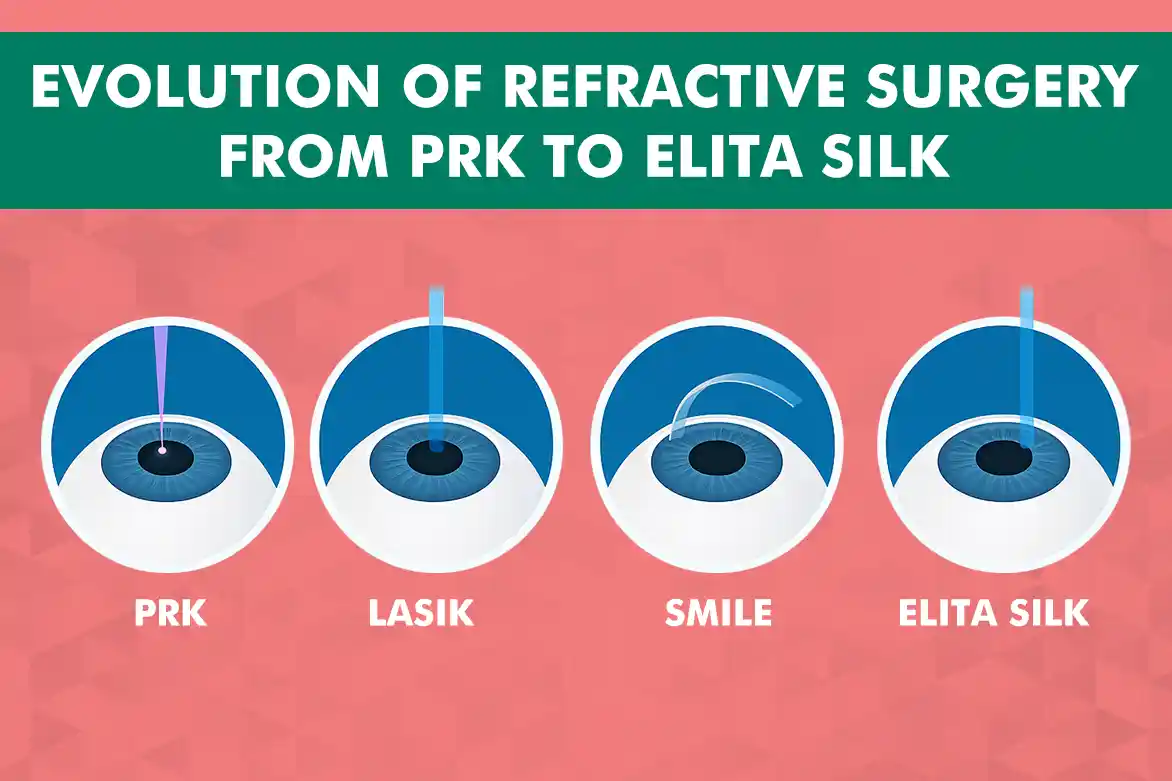 Evolution of Refractive Surgery: From PRK to ELITA SILK